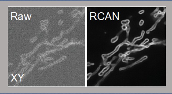 National Institute of Biomedical Imaging and Bioengineering