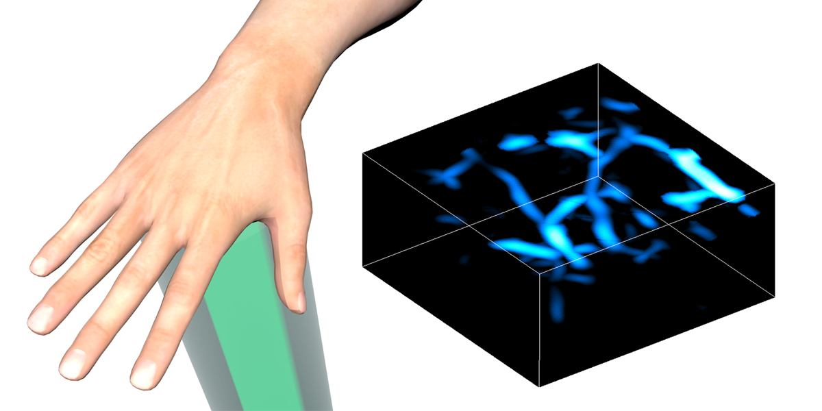 New technology brings advanced blood imaging closer to the clinic