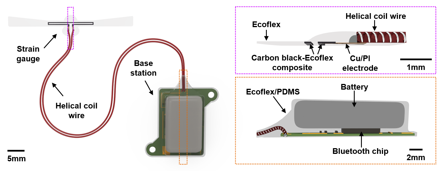 Bladder buzz: technologies to improve bladder surgery and monitoring